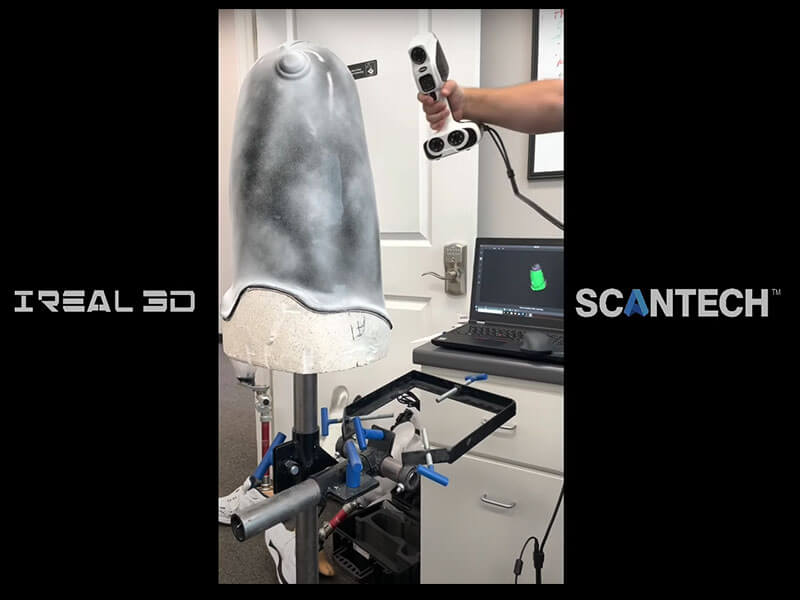 How to 3D Scan Prosthetic Cavity Using iReal 2E 3D Scanner